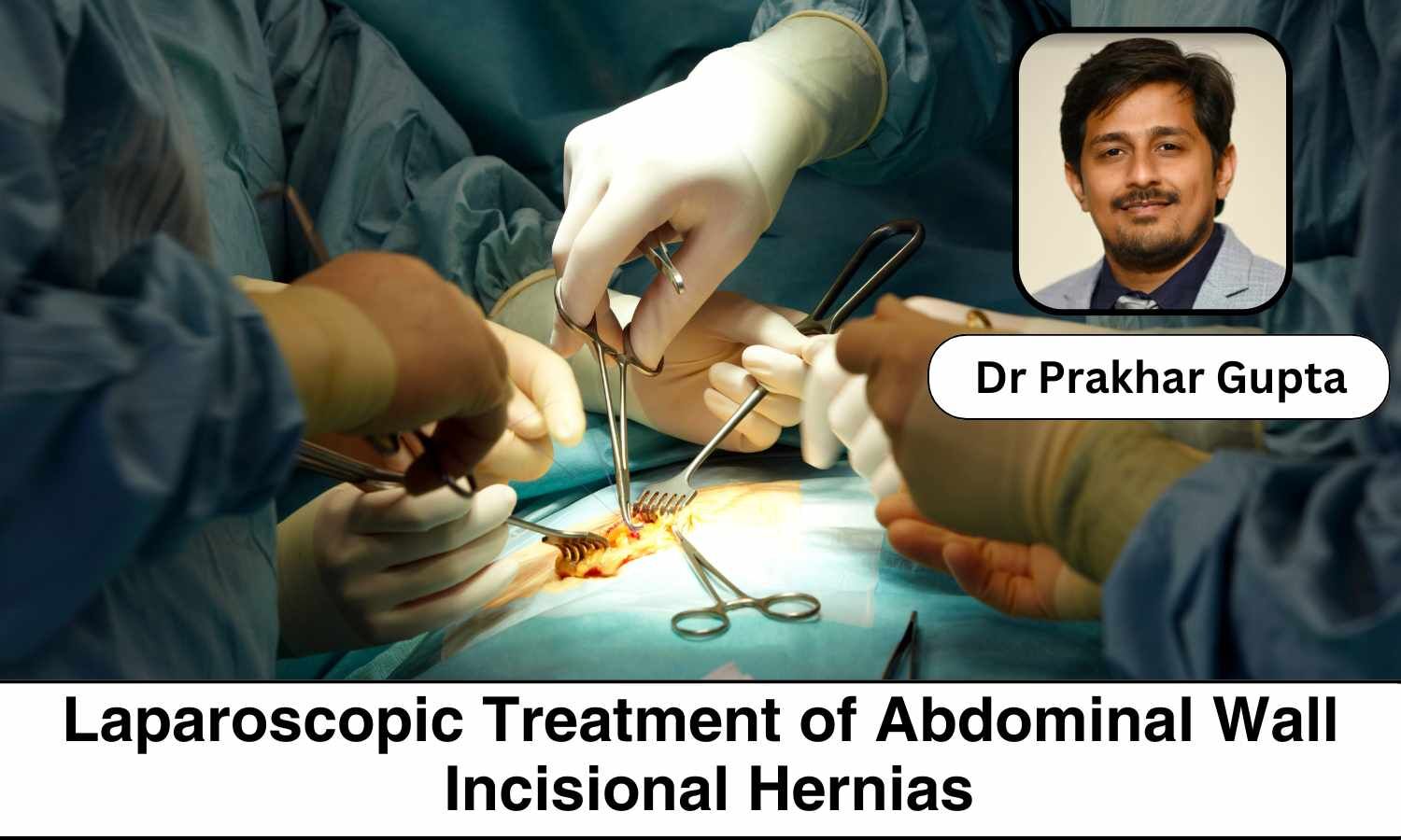 Laparoscopic Treatment of Abdominal Wall Incisional Hernias- Dr Prakhar ...