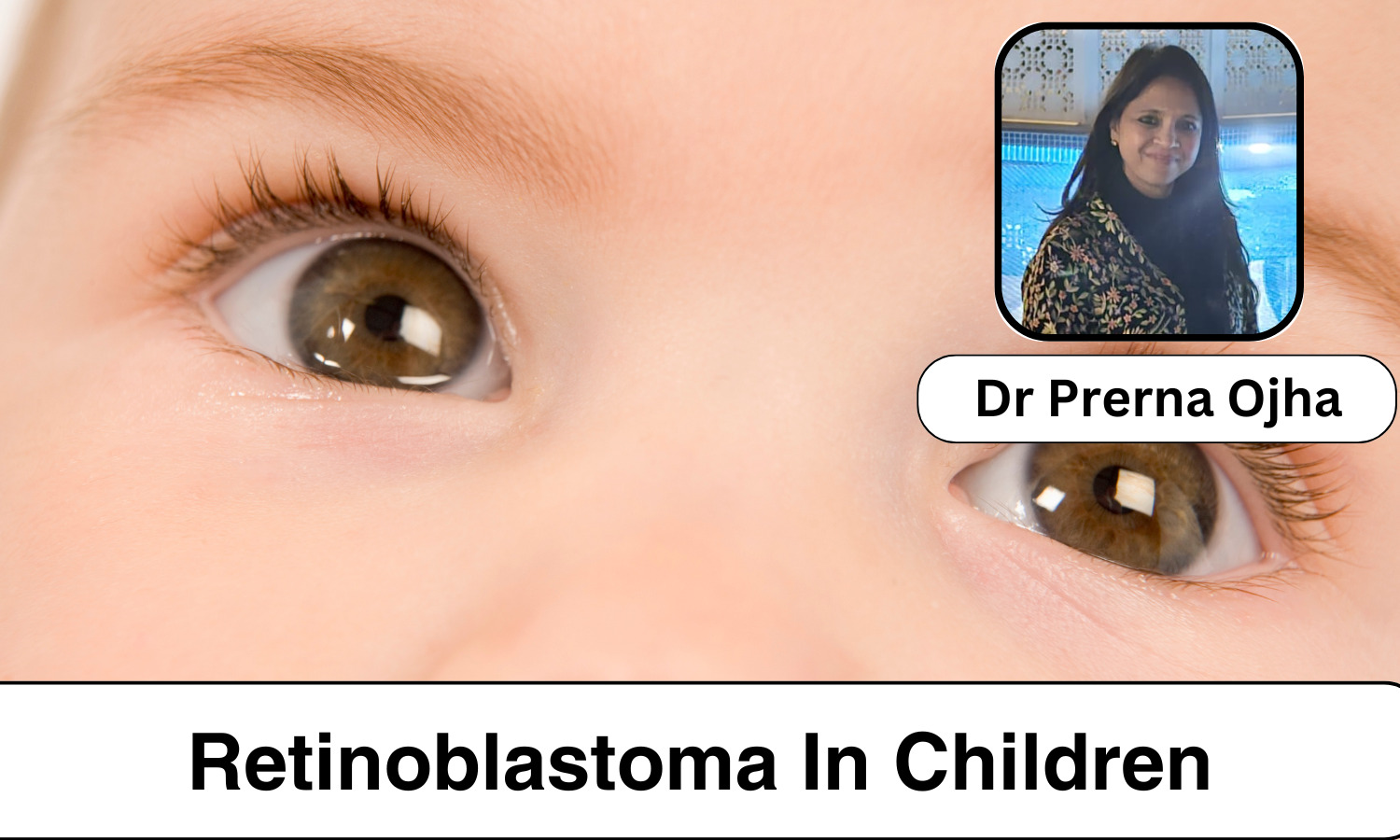 Retinoblastoma Symptoms CHECT UK On X: "It's National Eye Health Week