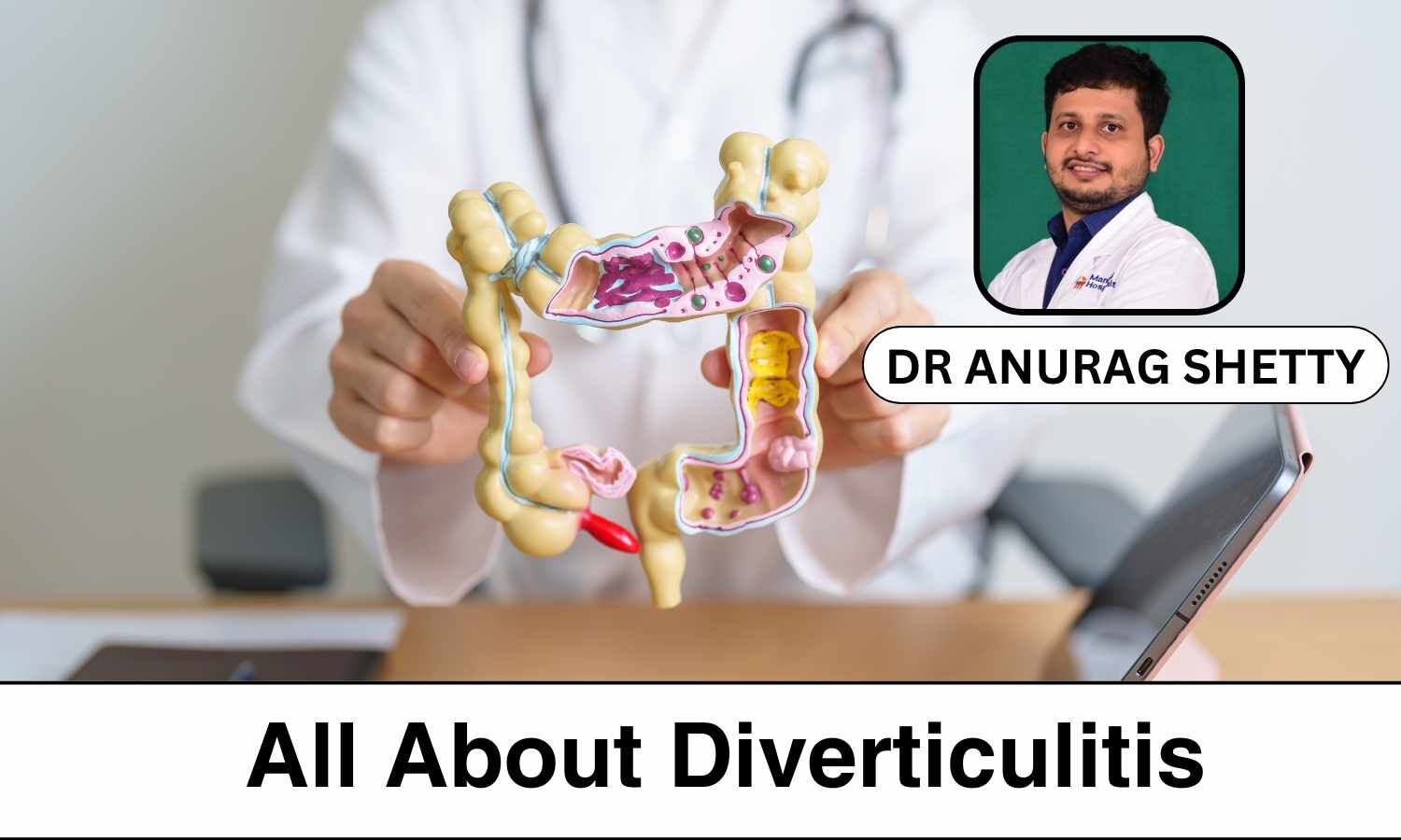 Understanding Diverticulitis: Risk Factors, Symptoms, Diagnosis ...