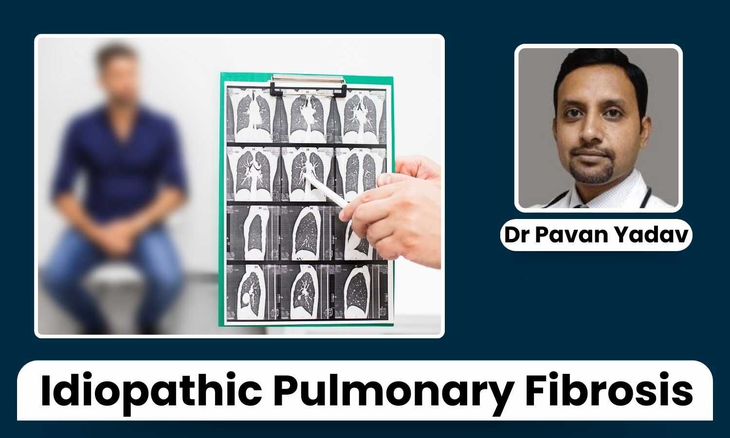 Idiopathic Pulmonary Fibrosis: Rare Disease Behind Zakir Hussain’s Death