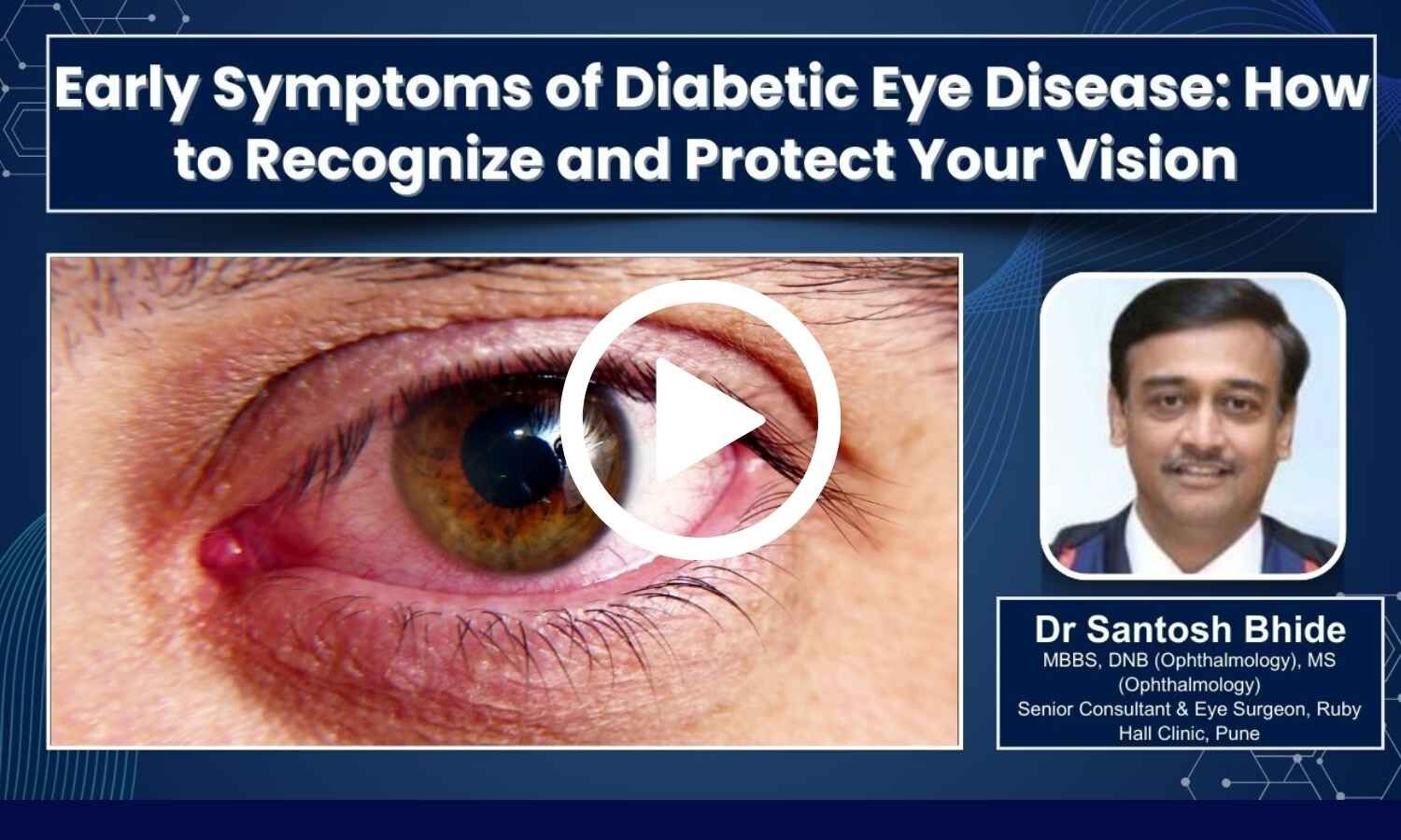Early Symptoms of Diabetic Eye Disease: How to Recognize and Protect ...