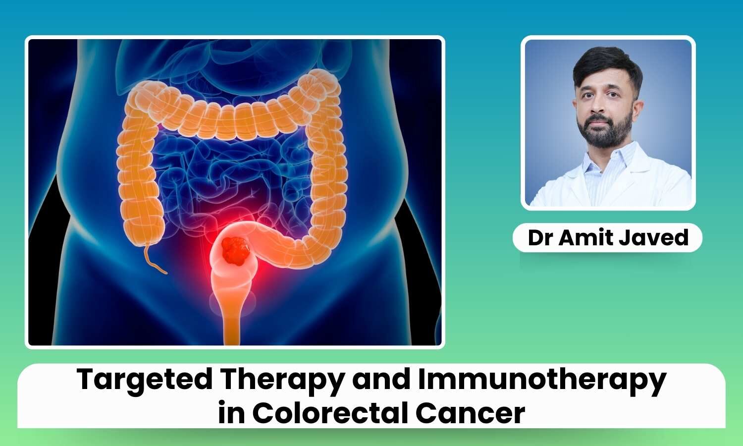 Targeted Therapy and Immunotherapy in Colorectal Cancer: Current ...