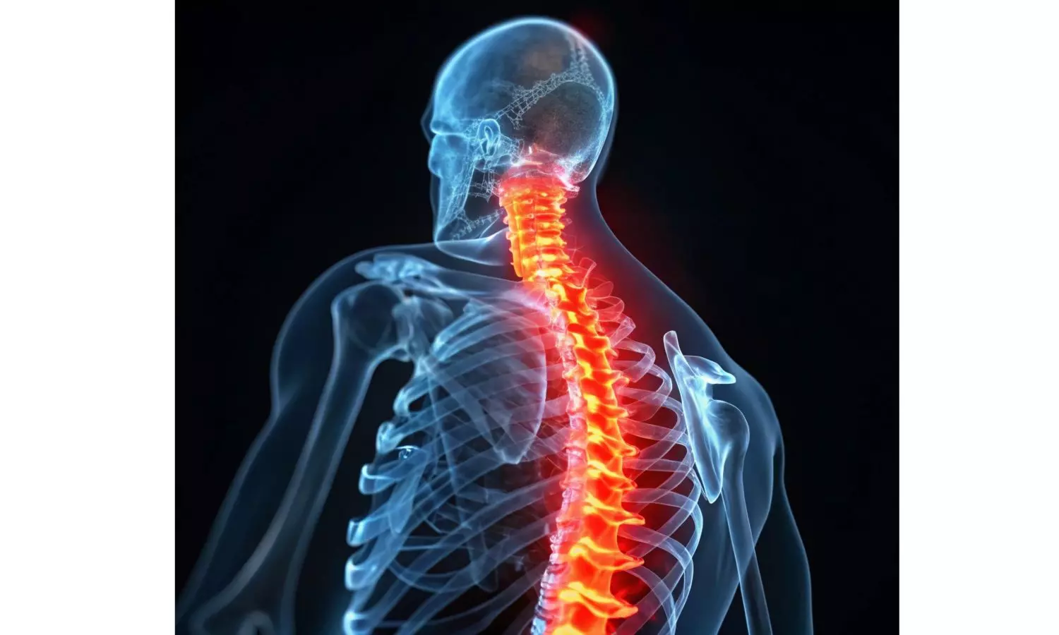 5 Common Spine Disorders and How to Treat Them -World Spine Day 2025