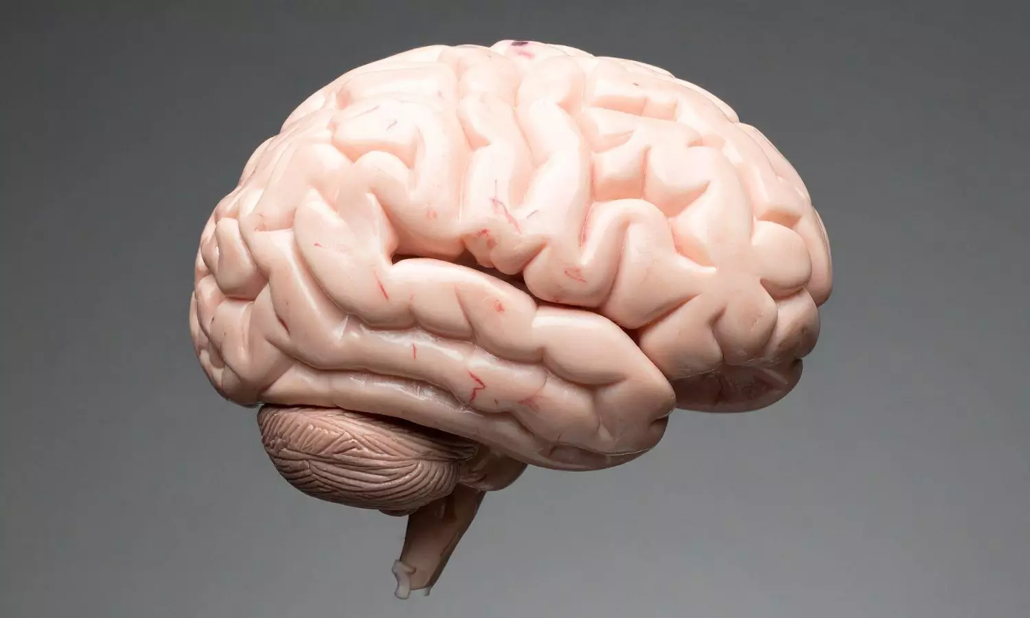 P. D. Hinduja Hospital Launches Advanced Neuro Rehabilitation Centre ...